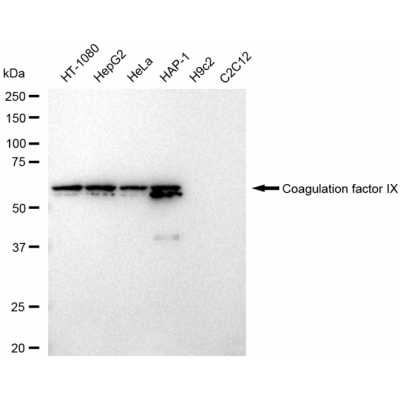 LifeSab™ FIX Rabbit mAb