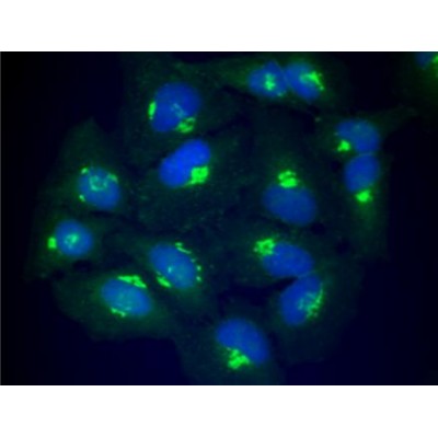 NBD C6-Ceramide